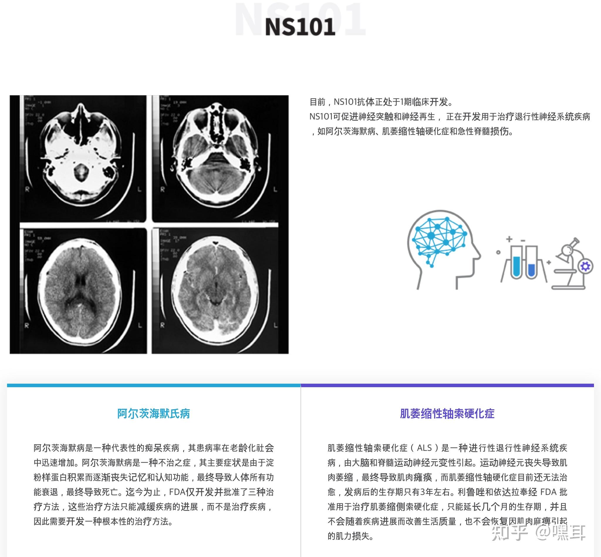 治疗听力损失的新药NS101正在招募对象进入临床试验 - 知乎