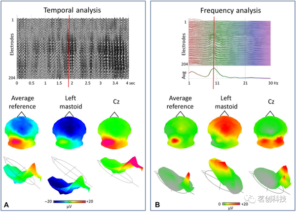 高分辨率EEG的空间分析 - 知乎