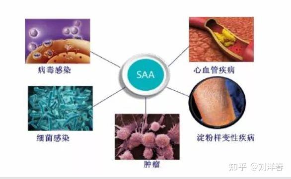 炎症四项检测刻不容缓，首先带你3分钟彻底了解SAA - 知乎