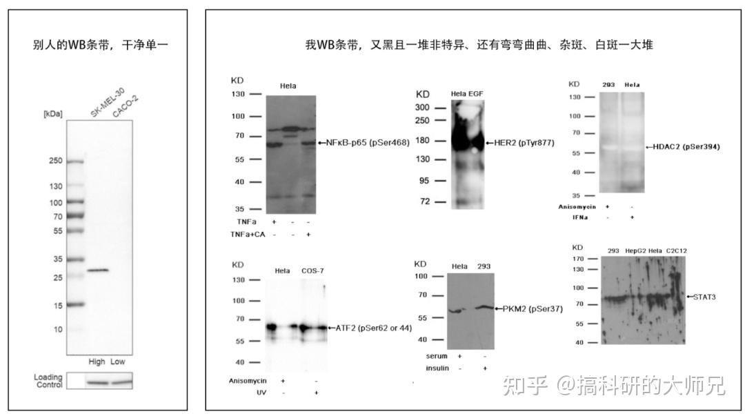 Western Blot内参不齐、非特异条带、背景黑、条带泛白...这么多问题，该怎么解决？一文教你跑出完理想WB结果！ - 知乎