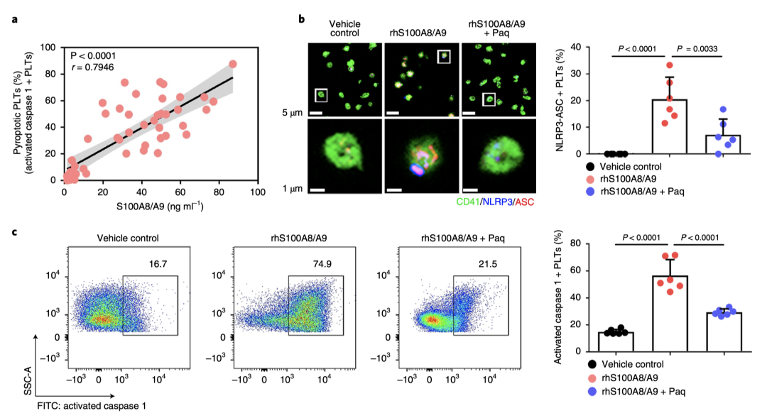 Nature最新大子刊丨脓毒症-血小板-GSDMD-NETs - 知乎