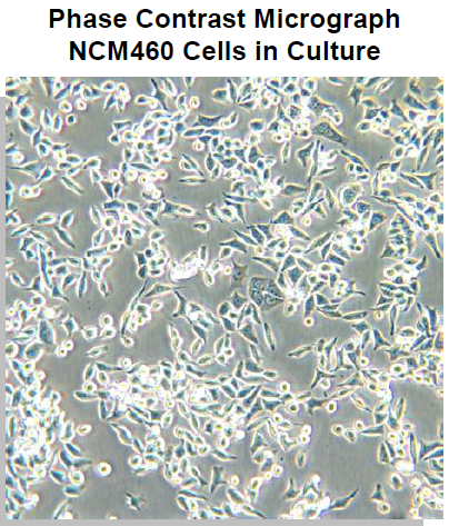 NCM-460:苏州鉴达细胞株鉴定预警系列8 - 知乎