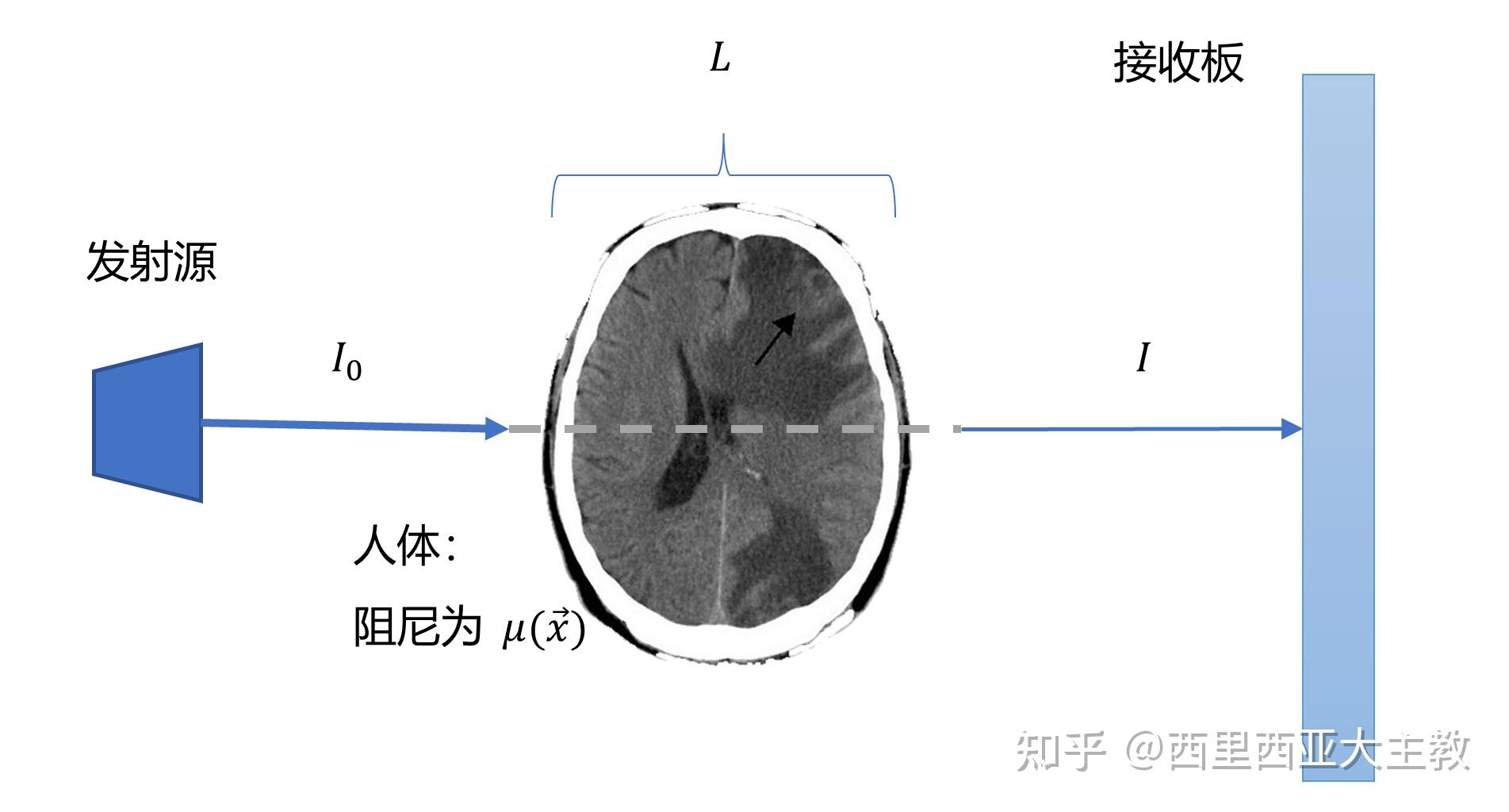 章节一: CT (computed tomography) 计算机断层扫描 - 知乎