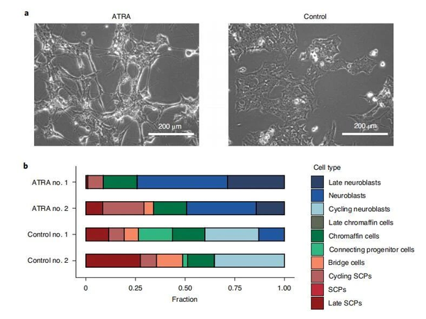 Nat Gen | 单细胞转录组学分析神经母细胞瘤的发育起源 - 知乎