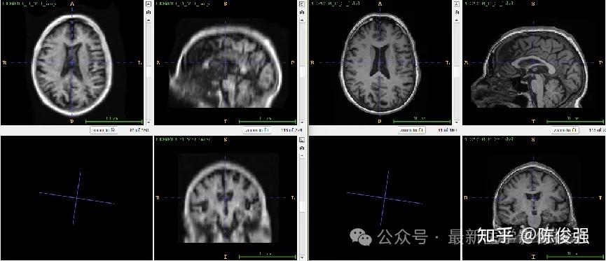 ULF-EnC2025——配对超低场 MRI 增强生成到高场 MRI - 知乎