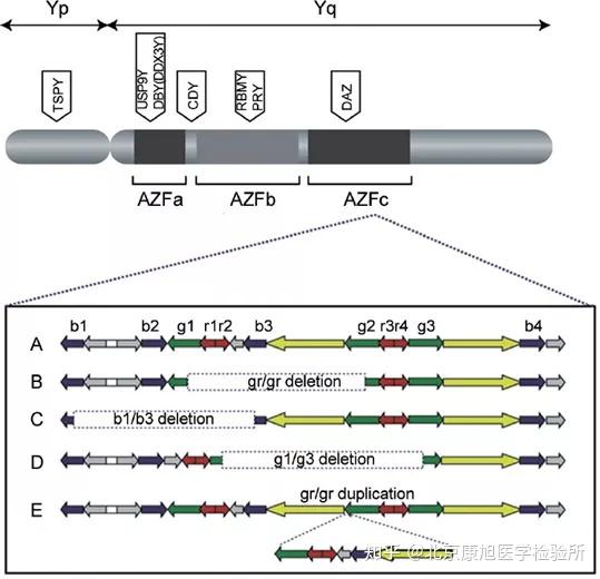 【生殖专题】查出Y染色体微缺失可以生育吗？ - 知乎