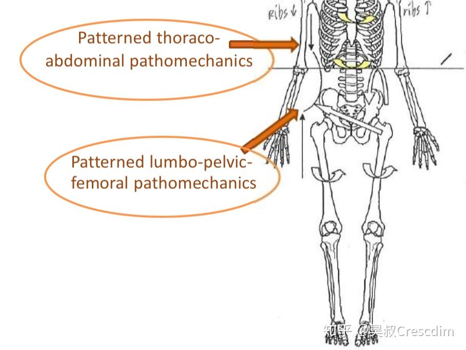 姿势恢复技术（PRI Method）在骶髂关节康复中的应用（上篇） - 知乎