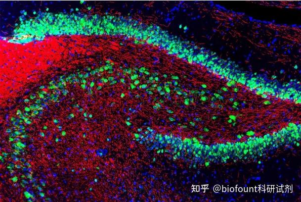 NeuN 和 MAP2 有什么区别 - 知乎