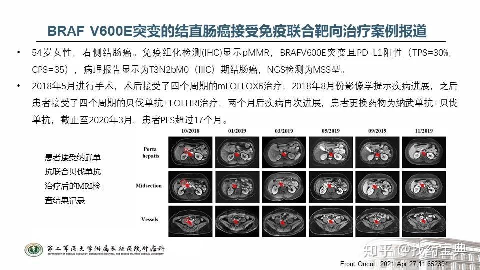 同肿瘤同基因，治疗方案大不同？第20轮长征MTB深入解密BRAF变异的消化道肿瘤 - 知乎