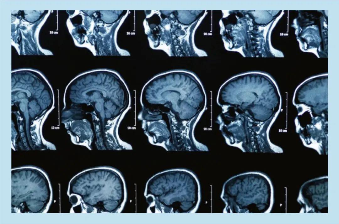 如何快速搞懂CT&MRA&DSA这些医学影像检查技术的区别？ - 知乎