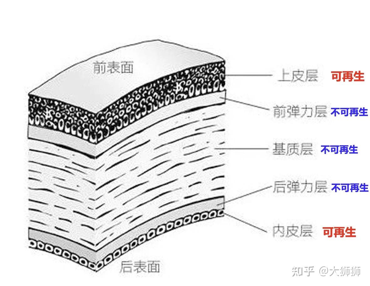 我的近视手术（上篇）为什么我会推荐你首选TPRK，而不是飞秒？ - 知乎