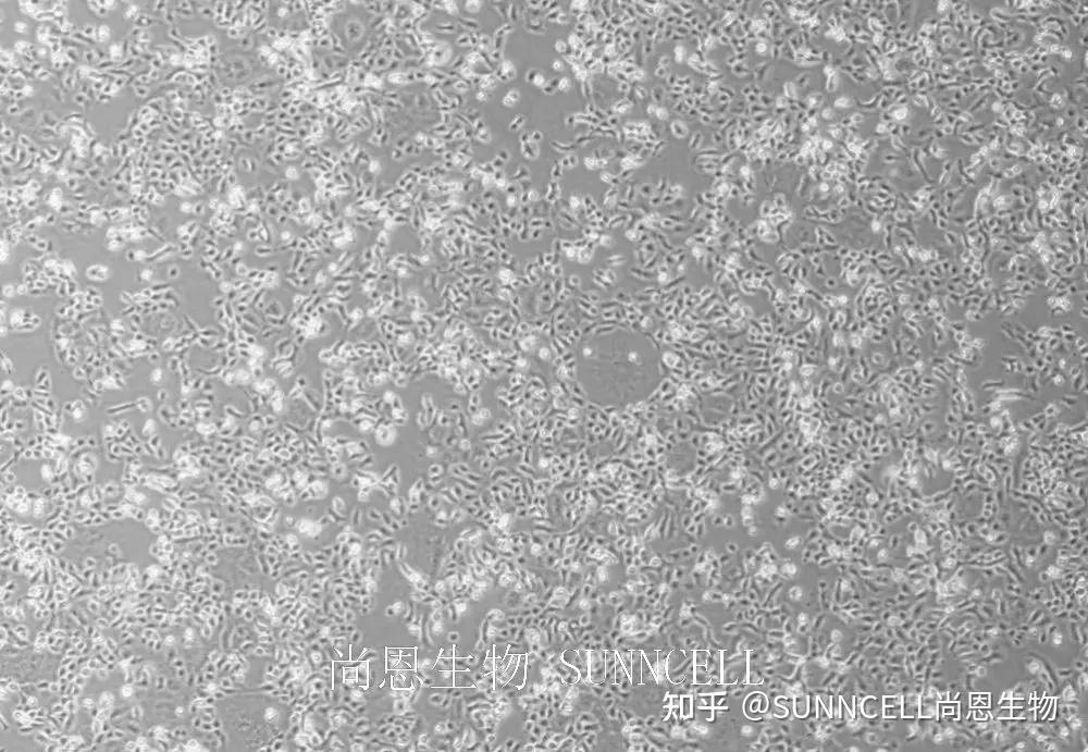 武汉尚恩生物MLE-12细胞助力揭示Celastrol对急性肺损伤的保护机制！ - 知乎