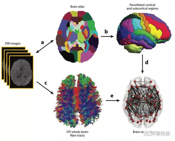 DTI在早期脑发育研究中的应用 - 知乎