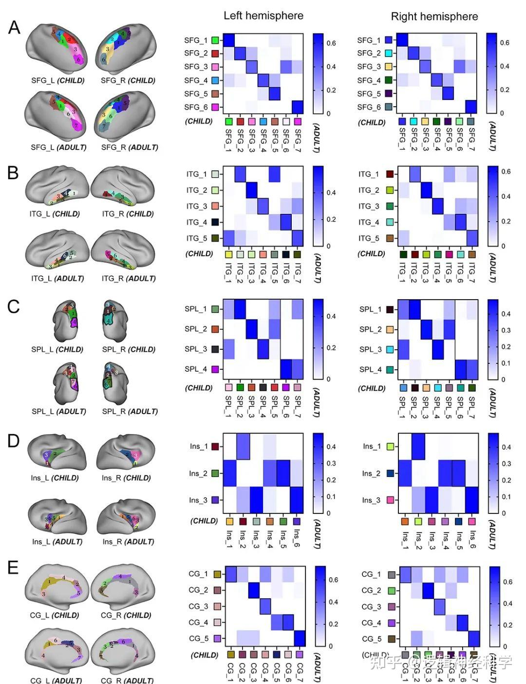 Cereb Cortex︱蒋田仔团队报道基于结构连接的脑网络组儿童图谱 - 知乎