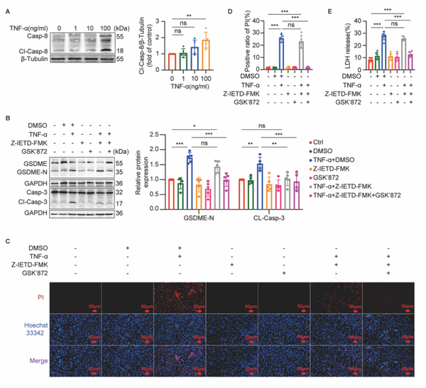 Cell Death Discov︱福医大附院谢良地团队揭示肌少症中TNF-α调控骨骼肌细胞发生细胞焦亡的分子机制 - 知乎