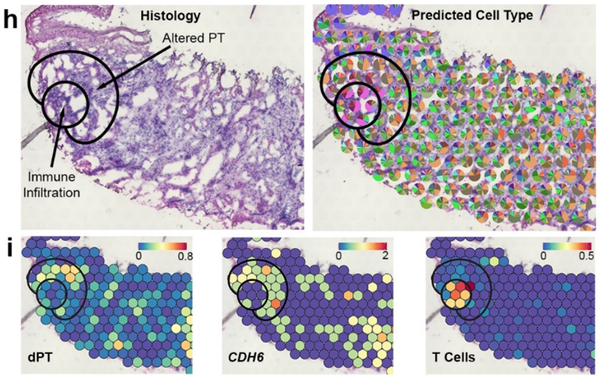 生信分析 | 空间转录组·SPOT去卷积—RCTD - 知乎