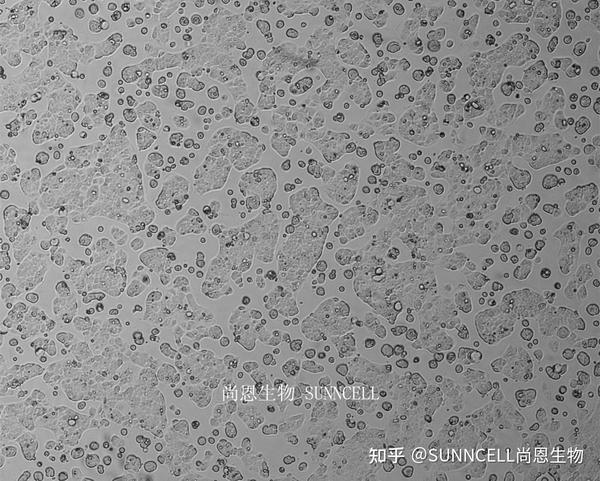 细胞攻略 | Caco-2(人结直肠腺癌细胞)培养教程 - 知乎