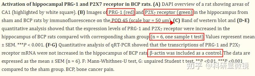 SCI写作-SCI文章中图例（figure legend）频频出问题，看看这篇文章怎么说 （基础实验版） - 知乎