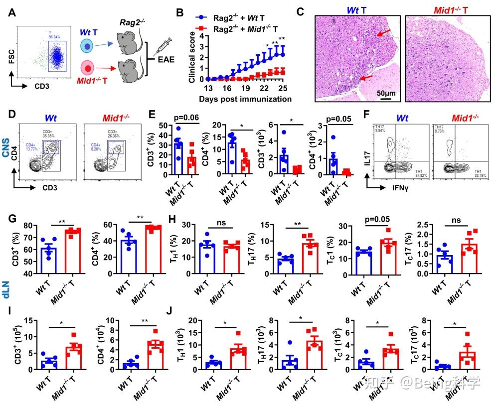 Theranostics︱华中科技大学课题组揭示自身反应性T细胞迁移机制，Mid1是关键调控因子 - 知乎