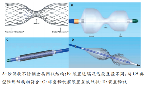 冠状静脉窦缩窄装置：强生 vs. VahatiCor - 知乎