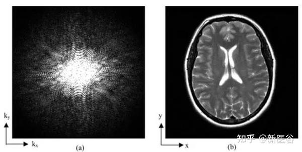影像时间|MRI的“存储器”——K Space - 知乎