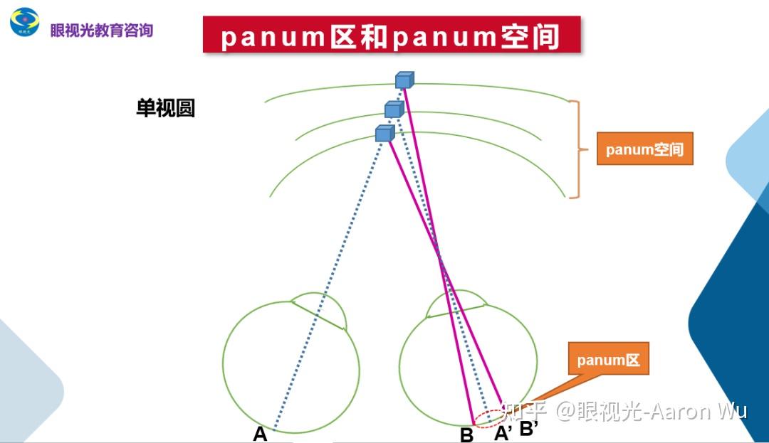 《一次吃透》系列栏目9—双眼视功能基础 - 知乎