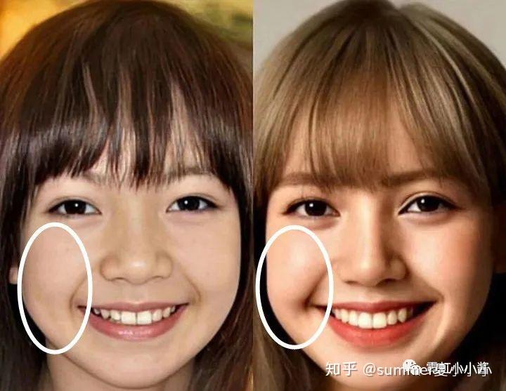 我们在争论Lisa整没整容的时候，人家已经是最大赢家了|日本医美 - 知乎