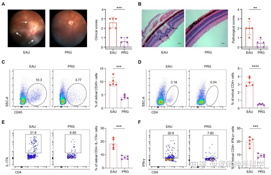 J Neuroinflammation︱中山大学苏文如团队揭示孕激素能够治疗葡萄膜炎及其分子机制 - 知乎