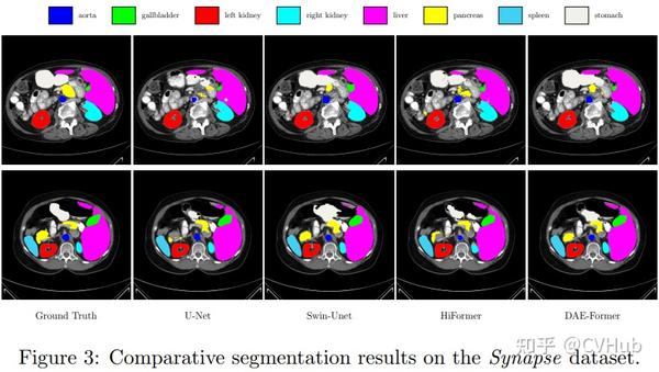 卷麻了！ Dae Former：高效双重注意力引导的transformer网络称霸医学图像分割任务 知乎