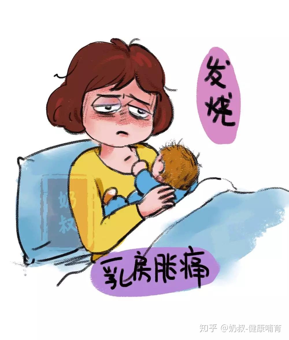 哺乳期乳腺炎 随意云