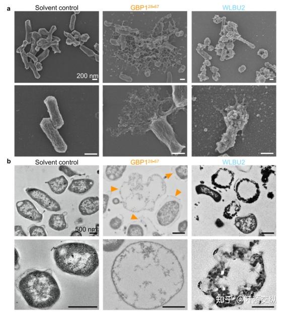 “鸟苷酸结合蛋白”一种应对抗生素耐药性的新发现 - 知乎