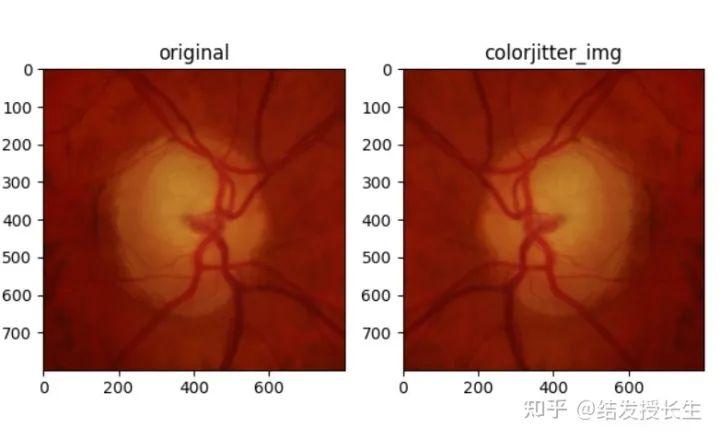 实战｜13个Pytorch 图像增强方法总结（附代码） - 知乎