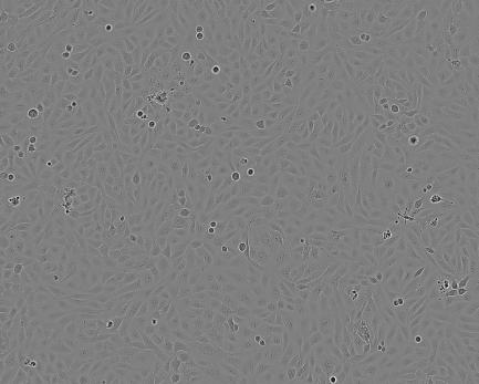 支气管上皮细胞BEAS-2B与CRISPR/Cas9基因编辑的美妙联动！ - 知乎