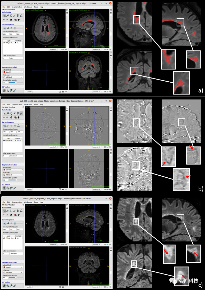 BMAT：一个开源的BIDS管理和分析工具 - 知乎