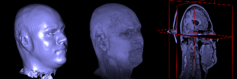 ImageJ实用技巧——3D可视化及测量(定量分析篇) - 知乎