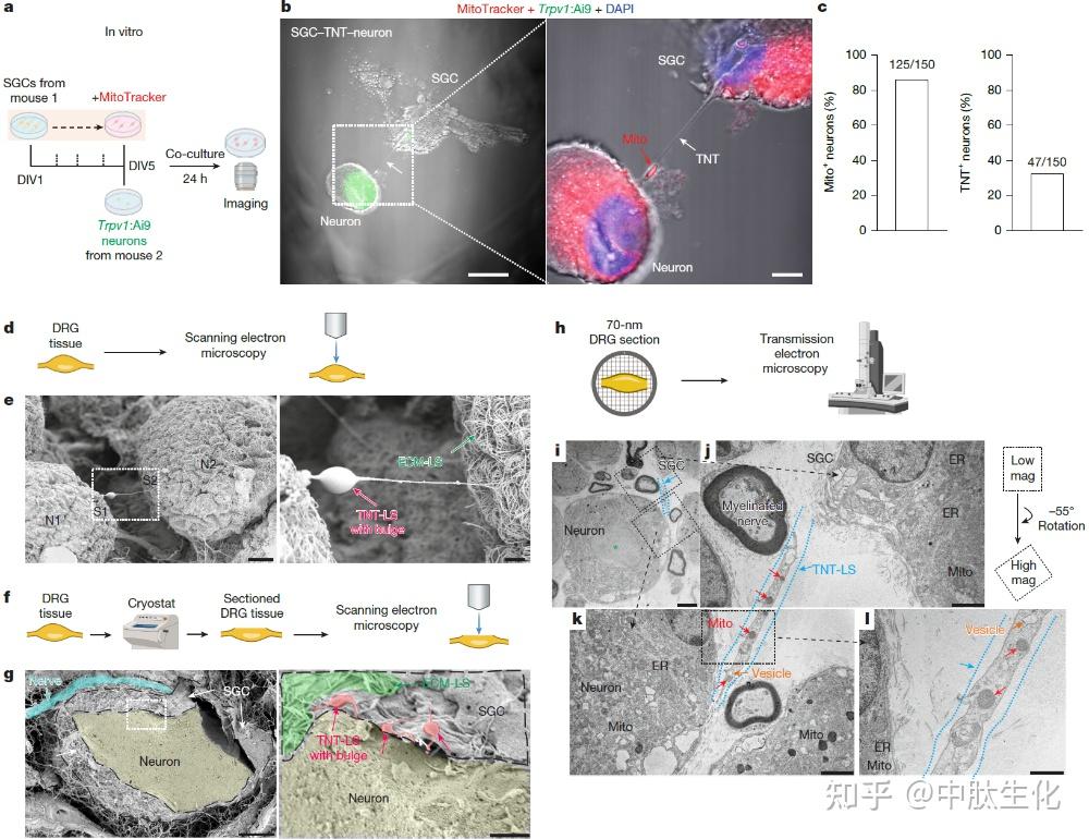 Nature：纪如荣团队发现胶质细胞可向神经元 “输送线粒体” ，保护外周神经 - 知乎