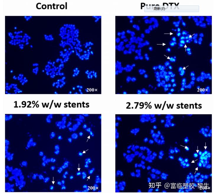 镍钛诺支架药物涂层：Chronosil 80A 5% - 知乎