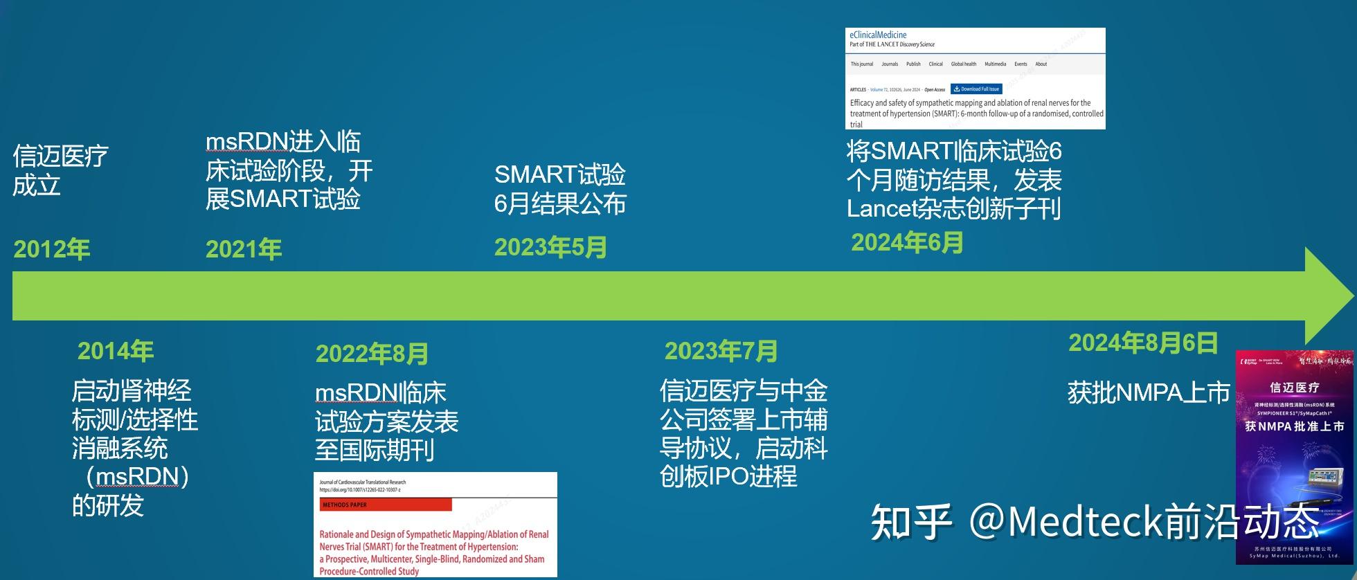 RDN标测：如何用“电刺激”找到高血压的“罪魁祸首”？ - 知乎