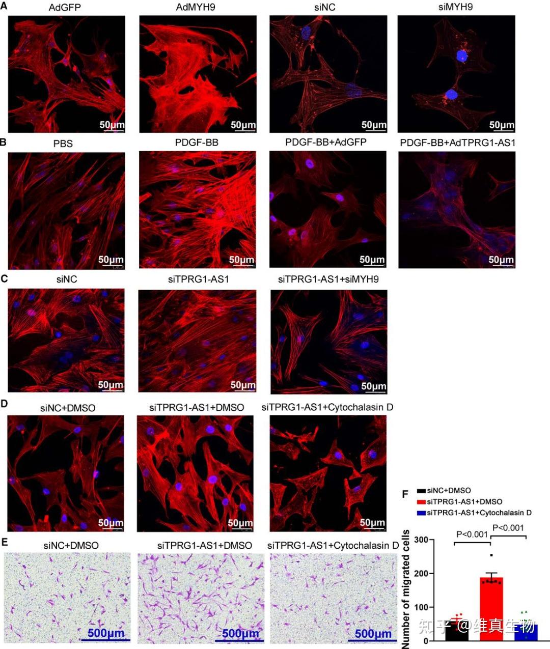 中国医学科学院阜外医院王来元/顾东风研究团队揭示LncRNA TPRG1-AS1在抑制动脉粥样硬化中的关键作用! - 知乎