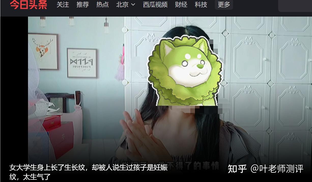 肥胖纹怎么办?10年肥胖纹坚持淡化3年后,终于算是有点有用的东西分享给大家 知乎