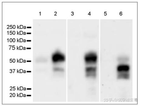 【小优细节君】c-Fos的WB怎么做？ - 知乎
