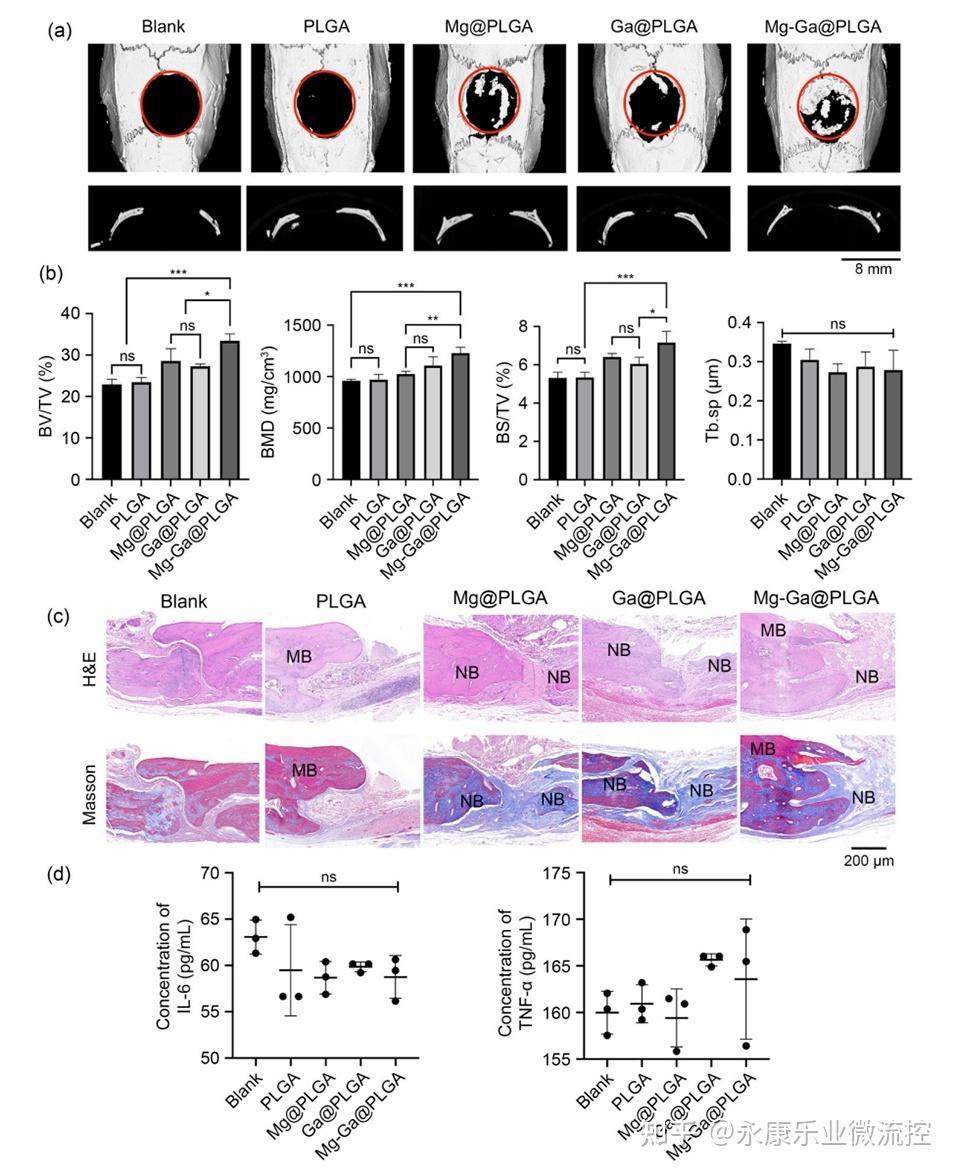 天津环境医学与作业医学研究所王新兴&天津医科大学口腔医院陈刚：镁镓共负载微球通过促进成骨和抗菌作用加速骨修复 - 知乎