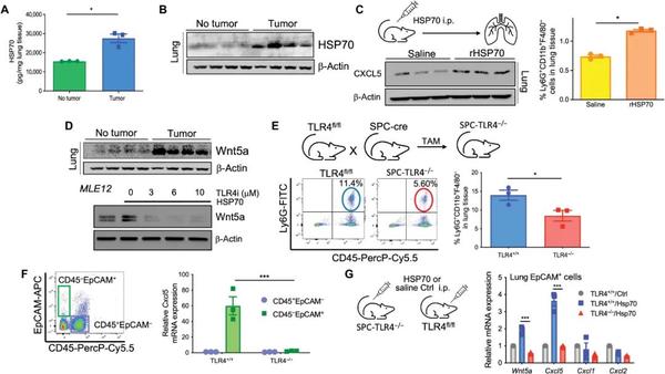 STM | 瘤内NLRP3-HSP70-TLR4轴在抗PD-1治疗期间驱动转移前生态位/肿瘤超进展 - 知乎