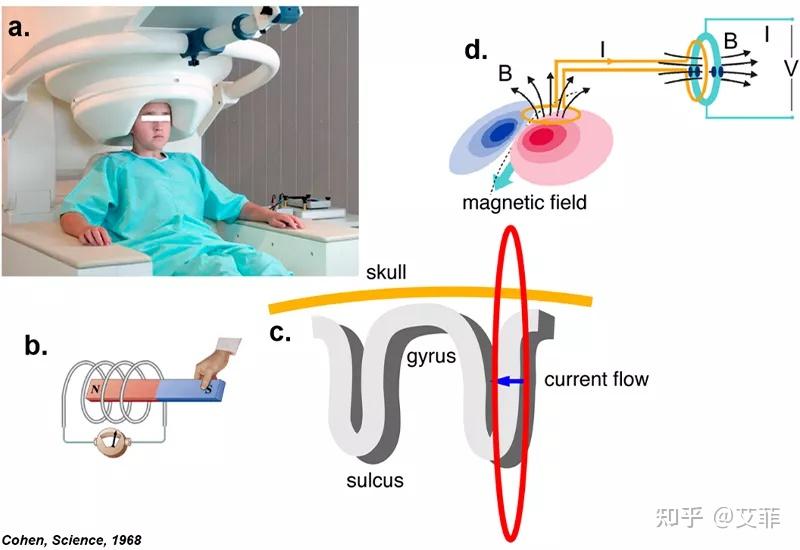 脑科学研究方法（五）脑磁图 - 知乎
