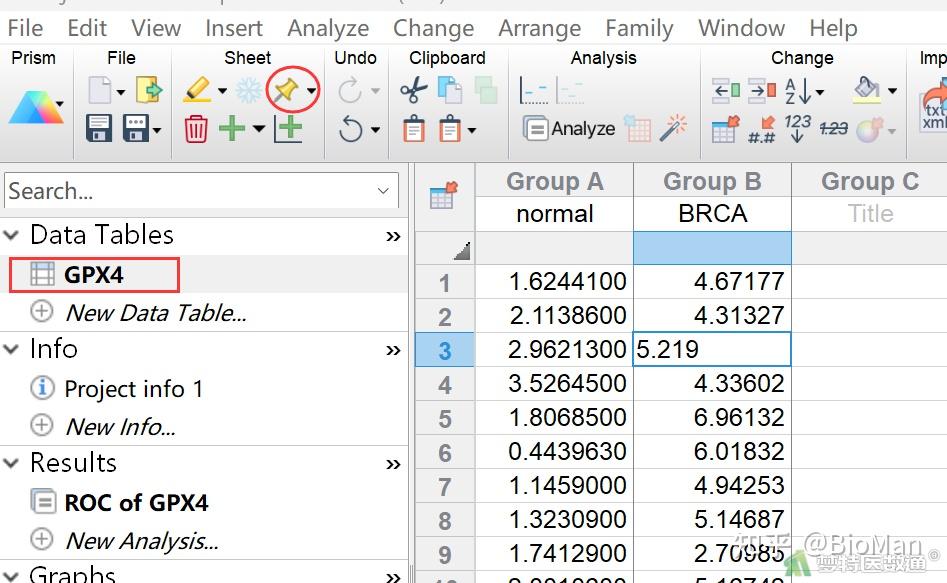 GraphPad Prism纵列表统计分析——ROC曲线绘制 (ROC curve) - 知乎