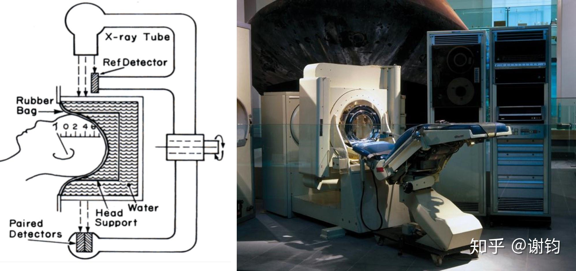 现代医学成像（3）——CT（基本原理与图像重建） - 知乎
