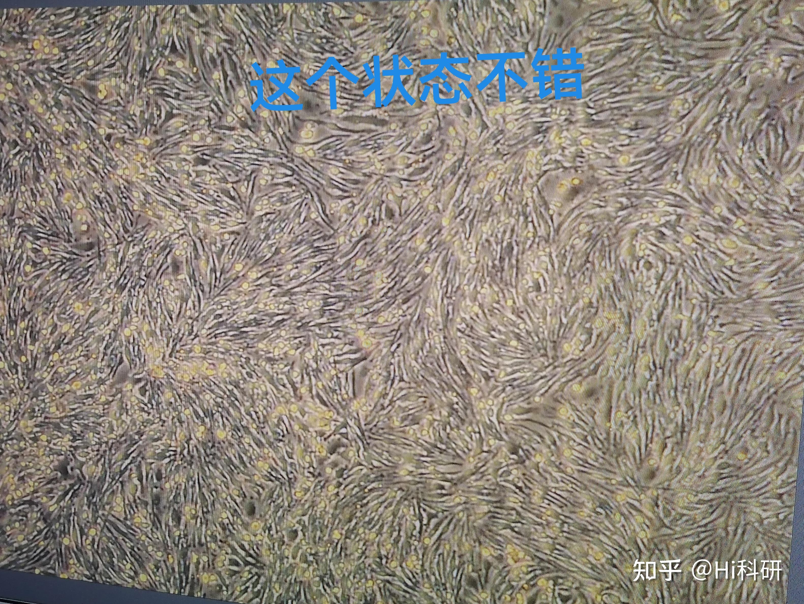 Bmdm小鼠骨髓源性原代细胞培养 生物实验 研究生 知乎
