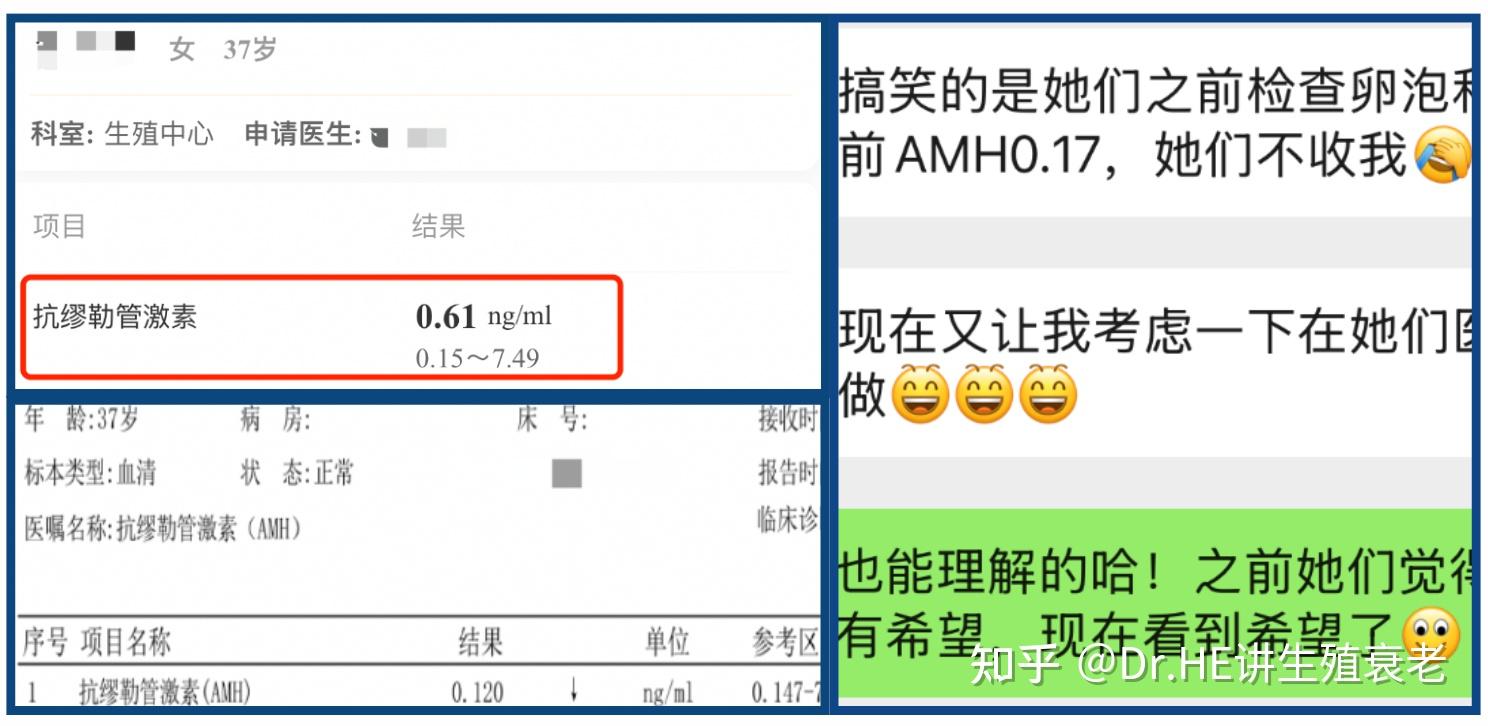 【AMH值提升408.3%】EET改善卵巢储备功能的临床应用：一例DOR患者的治疗过程与效果分析 - 知乎