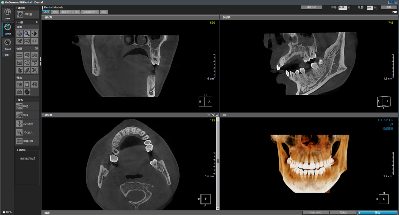 伯爵CBCT影像篇 ⑦：产品特点 - 知乎