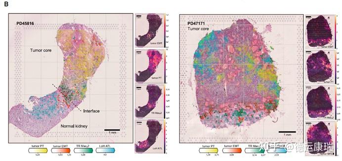 聚焦生信 | Cell2location法联合单细胞转录组进行空间转录组细胞类型映射-附代码 - 知乎